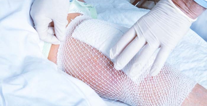 Filet tubulaire toutes tailles - SURGIFIX et jersey tubulaire